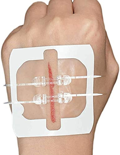 2 Pcs Zip Stitch Sutures Extra Large Band Aid Waterproof Butterfly ...