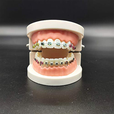 TDOU Dental 1:1 Demonstration Orthodontic Treatment Teeth Model - For ...