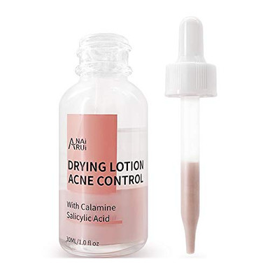 Acne Drying Lotion, Acne Spot Treatment, Blemish Pimples Zit Cream ...