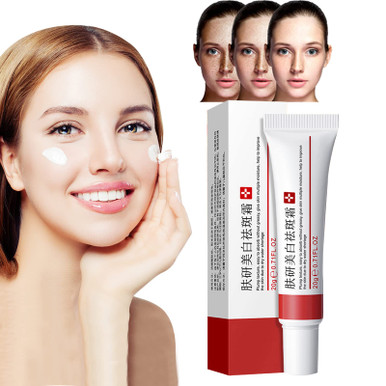 Spot off Freckle Whitening Cream, Freckle Remover Cream, Freckle ...