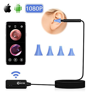 WiFi Otoscope Camera, KZYEE New Upgraded 1080P HD Visual Ear Scope ...