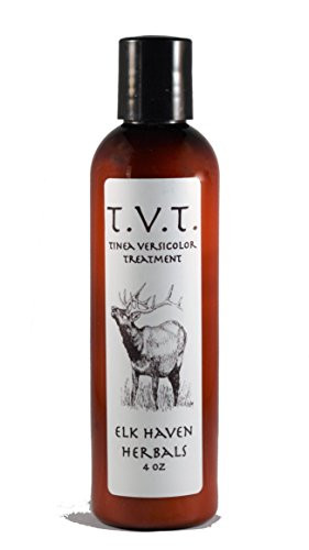 TVT Tinea Versicolor Treatment and Cure - Warehousesoverstock