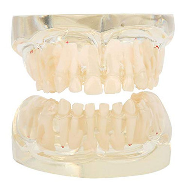 Dental Teeth Model Demonstration Teeth Model Deciduous Permanent Teeth ...