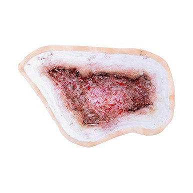 Forensic FX Skin Burn Pre Colored Silicone Prosthetic Appliance Special ...