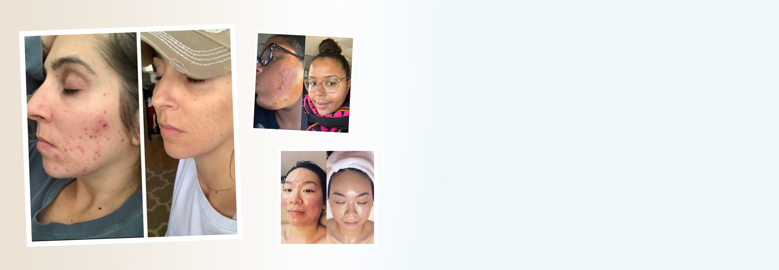 Holistic and Botanical Skin Care for Sensitive Skin | Blissoma
