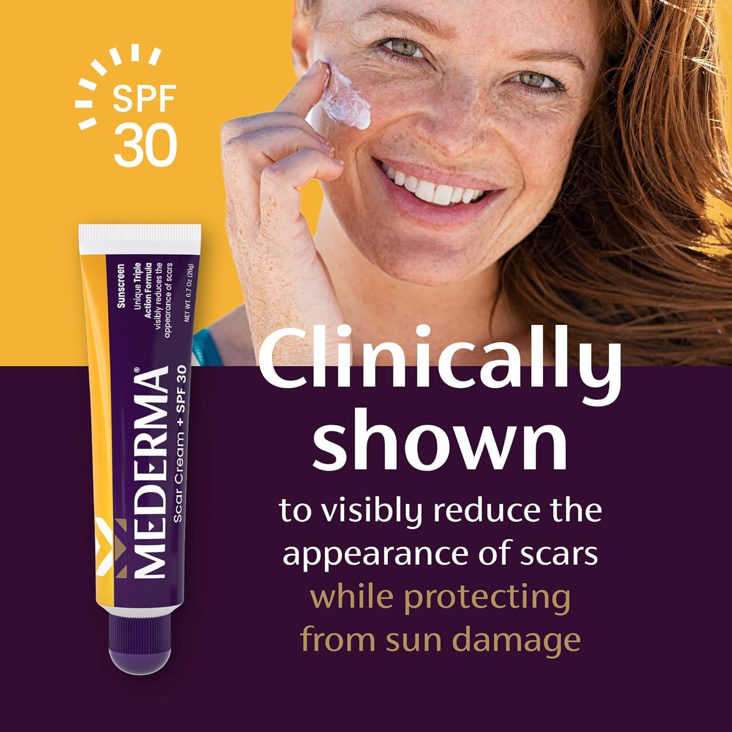 Mederma Scar Cream Plus SPF 30, Sunscreen, Protects from Sun Damage ...