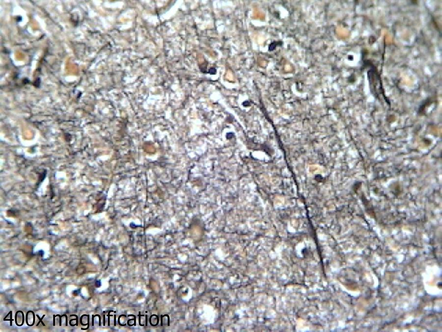Human Cerebrum Section Microscope Prepared Slide