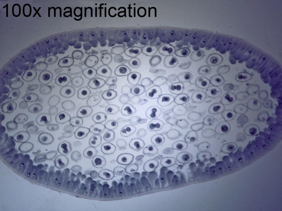 Whitefish (Coregonus) slide, mitosis, section
