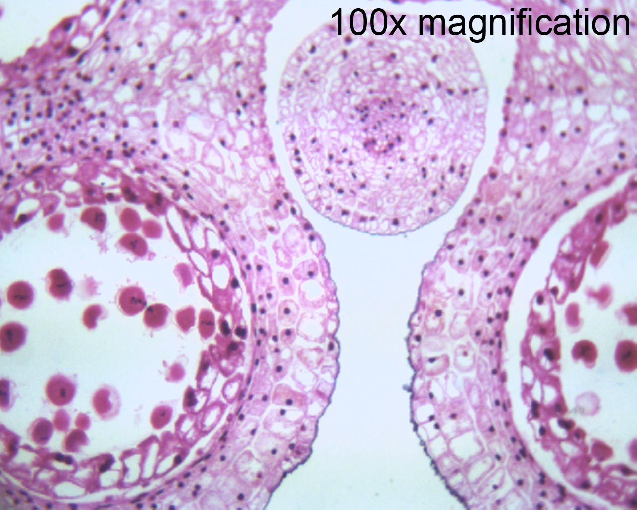 Lilium (Lily) slide, anther meiosis