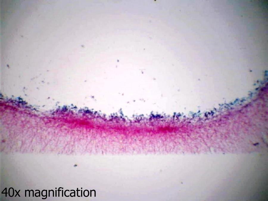 Penicillium (blue mold) slide, w.m.
