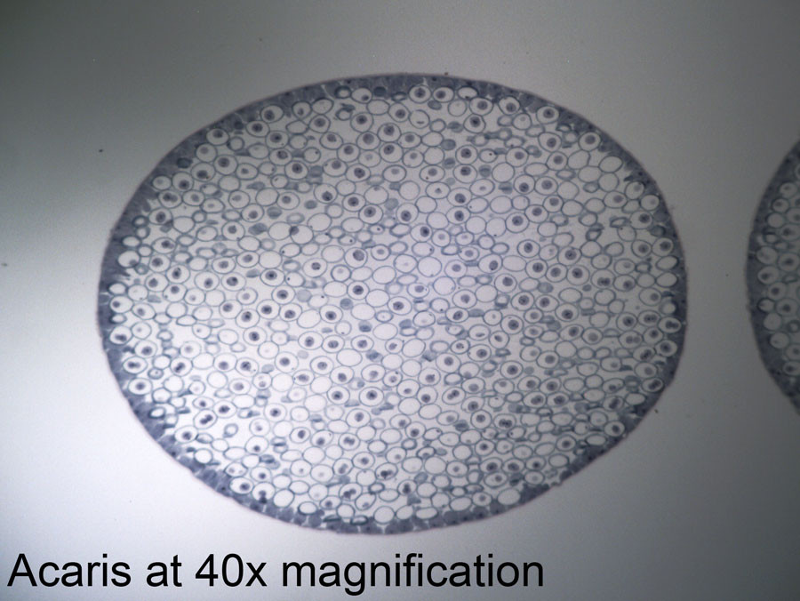 Ascaris Mitosis Slide