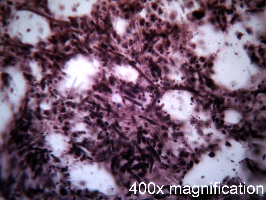 Grantia (Scypha) slide, l.s.