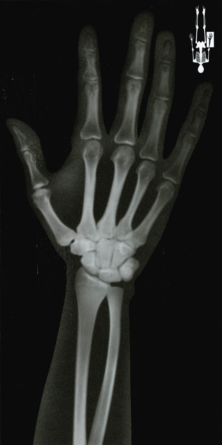Life Size Human X-Rays Set