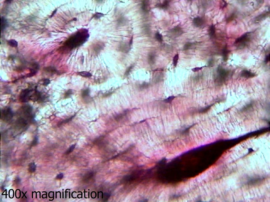 Human Bone Ground Microscope Prepared Slide