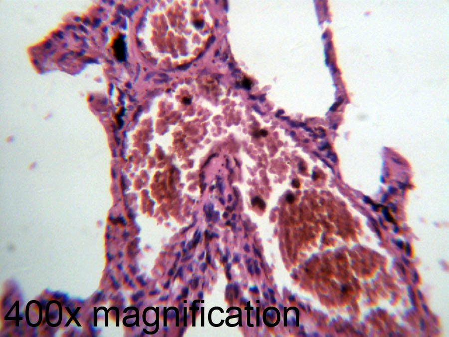 Human Pathology Slide Set