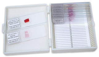 Human Pathology Slide Set