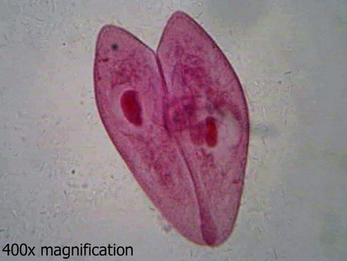 Biology Slide Set - 25 Prepared Microscope Slides for Biology | HST