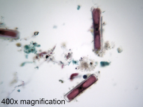 Biology Slide Set - 25 Prepared Microscope Slides for Biology | HST