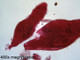 Rotifers slide, w.m.