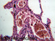 Human Pathology Slide Set
