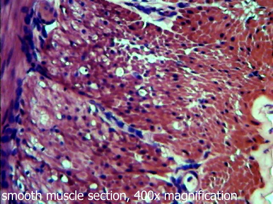 Muscle slide, 3 types, section