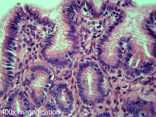 Human stomach slide, section