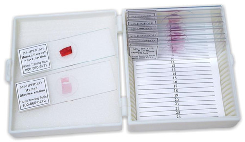 Human Pathology Slide Set