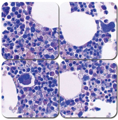 Optimized Giemsa Stain Kit, Pint - StatLab