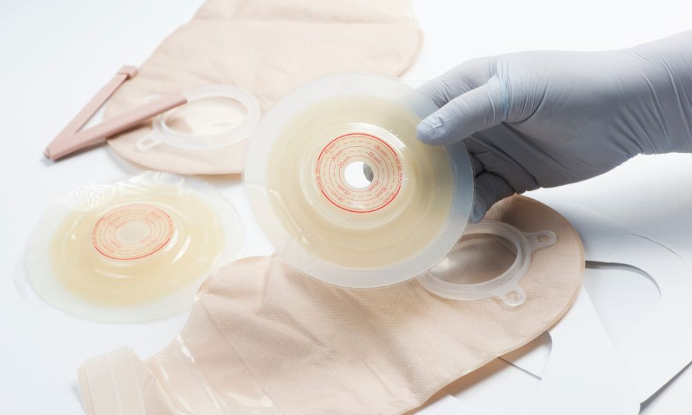 3 Types of Skin Barrier Products for Ostomy Care - My Care Supplies