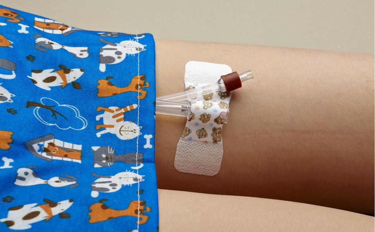 Centurion Pediatric Foley Anchor Securement Device