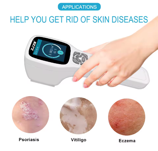 Compact UV Phototherapy Device for Skin Conditions