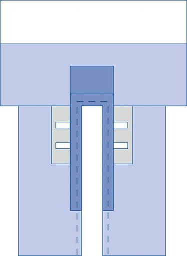 Sterile CV Split Surgical Drape with Clear Anesthesia Pouch