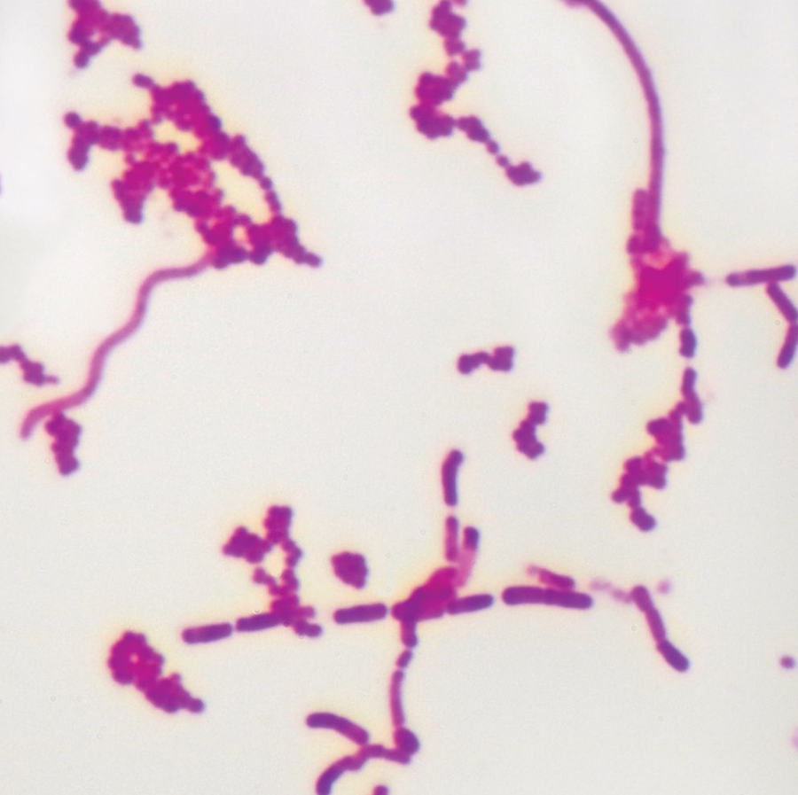 Mixed Smear of Bacteria Types Slide, w.m., Carbol-Fuchsin - Southern ...