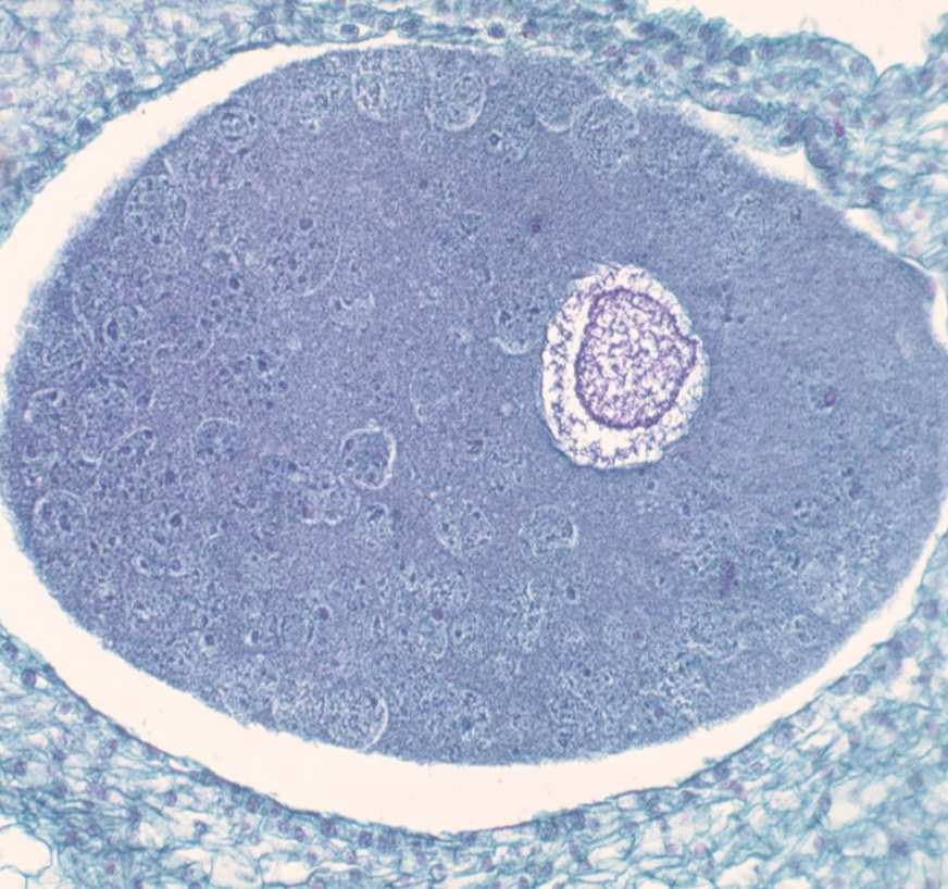 Pine Ovule, 12 µm Egg Nucleus, archegonium, LS Microscope slide ...