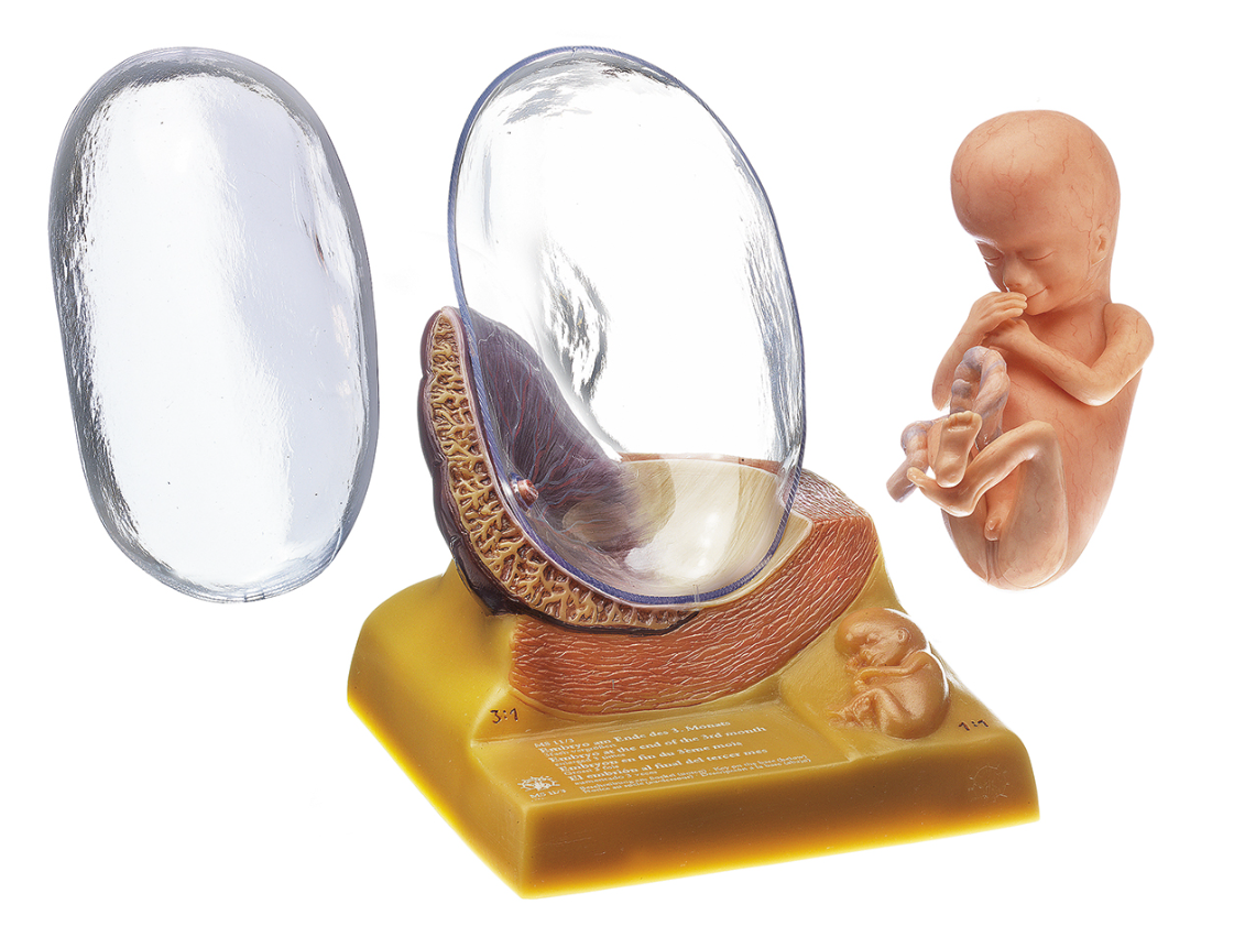 MS11/3 - Human Embryo in the Third Month