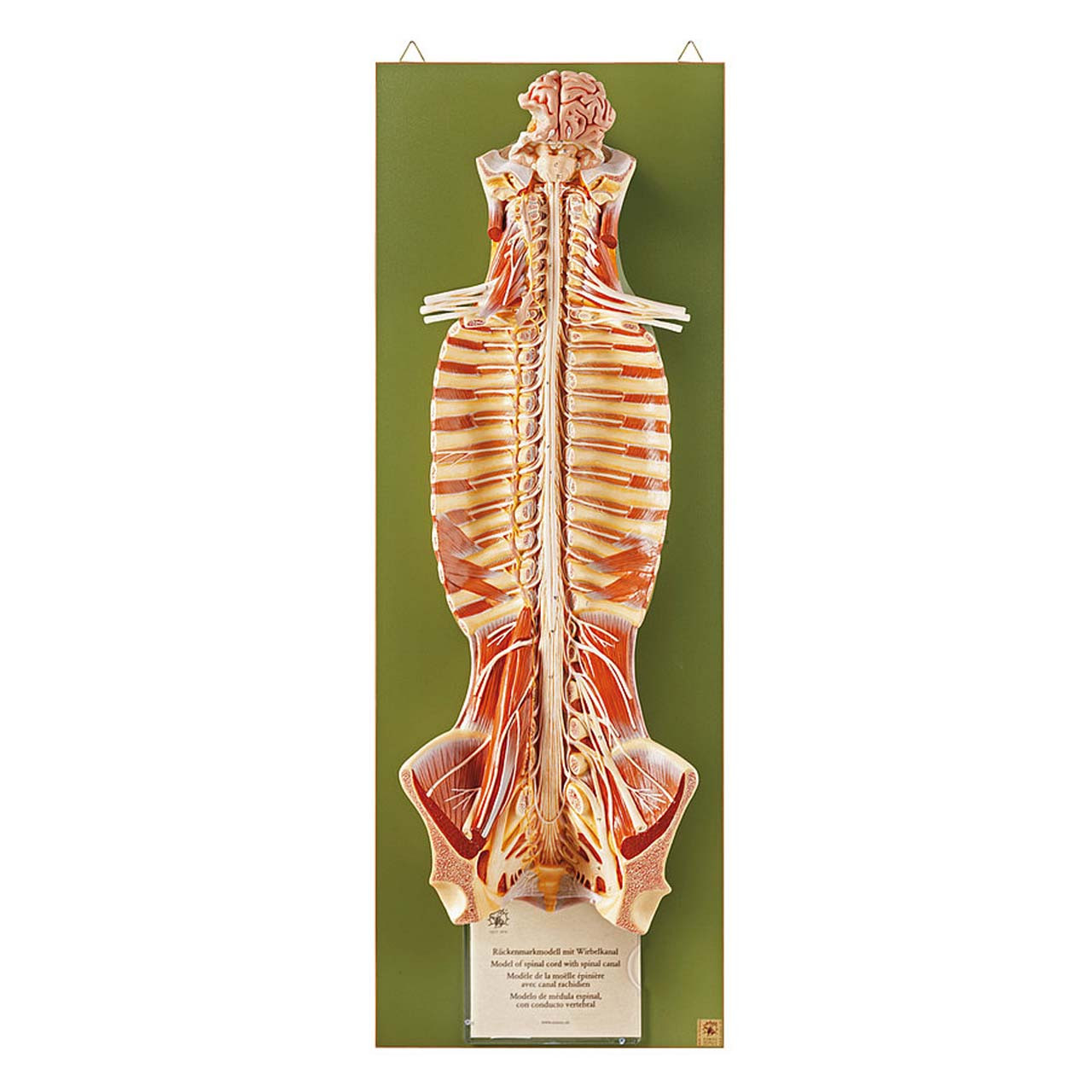 BS31 Spinal Cord In The Spinal Canal bs31-spinal-cord-in-the-spinal-canal