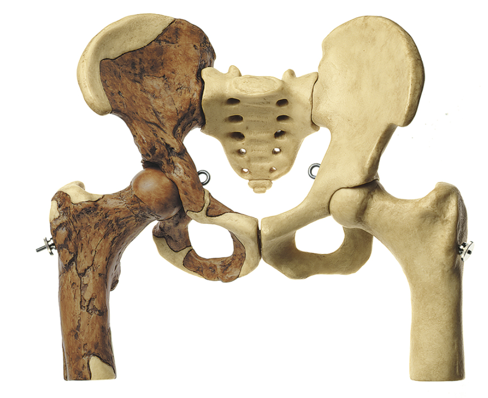 Somso Reconstruction of the Pelvis of Australopithecus africanus
