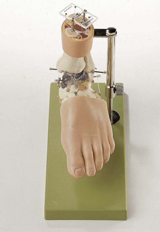 NS54/1 - Functional Model of the Tarsus