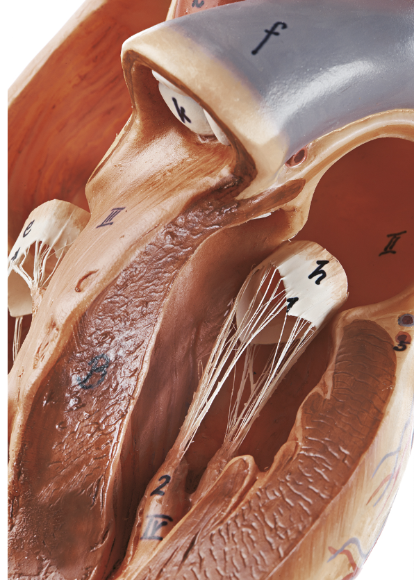 Model of the Heart with Bypass Vessels | Southern Biological