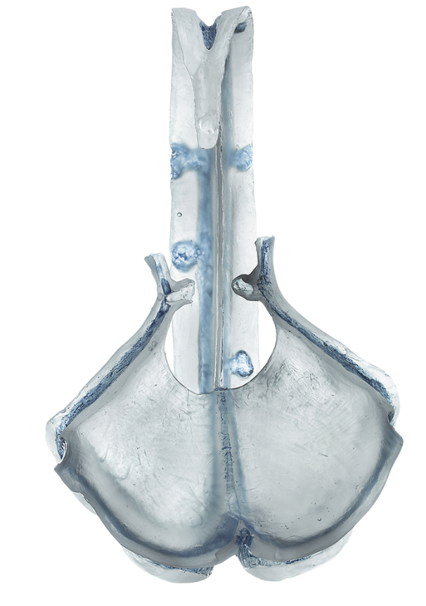 QS8/6 - Falx Cerebri