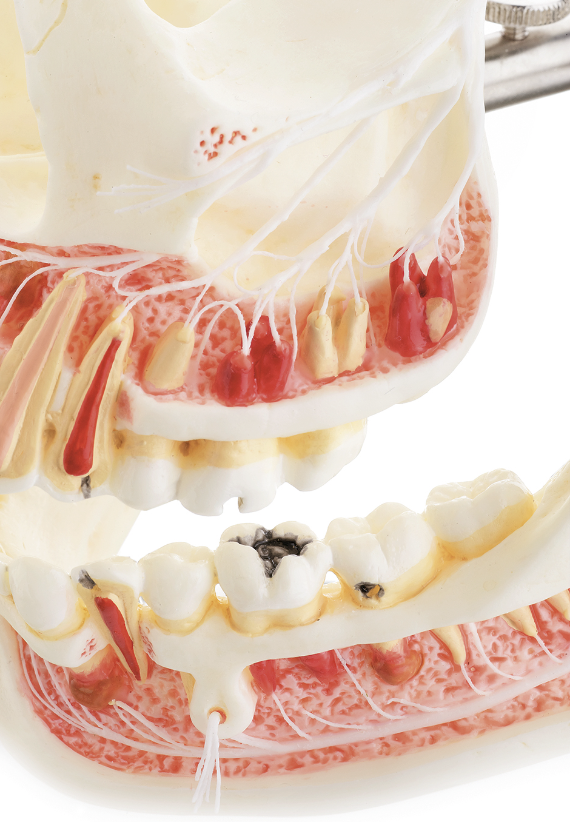 Somso Upper and Lower Jaw | Anatomical Model