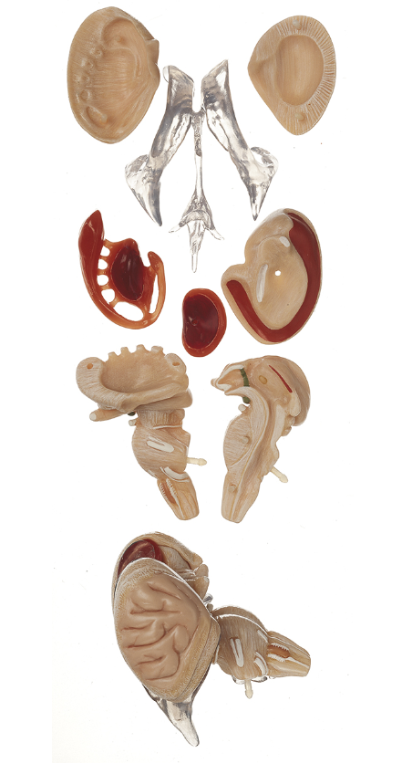 Somso Model of Brain Stem in 8 parts