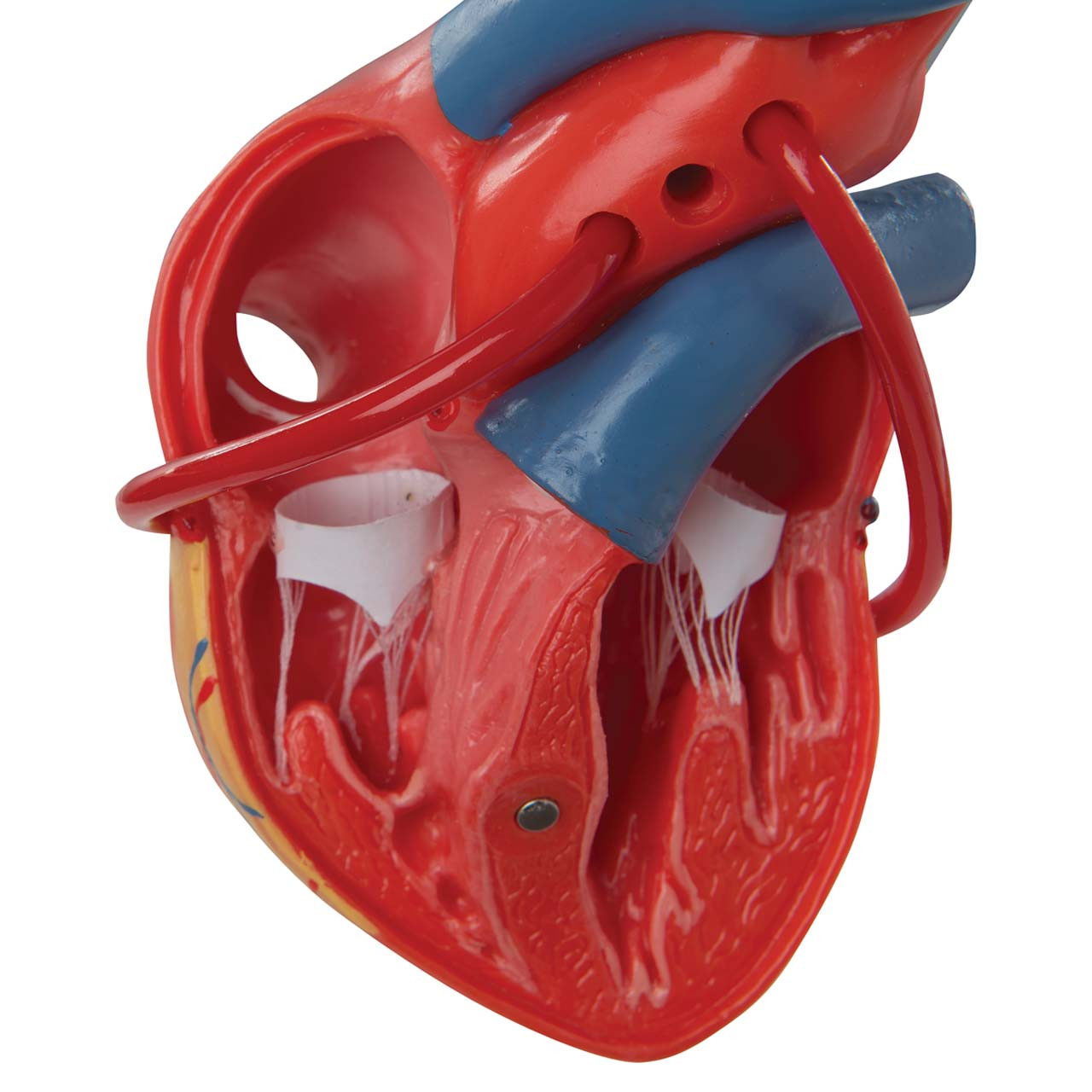 Classic Heart with Bypass, 2 part, Anatomical Model