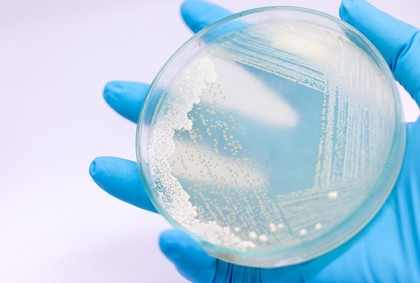 DNA Damage: The Impact of UV Light - Southern Biological