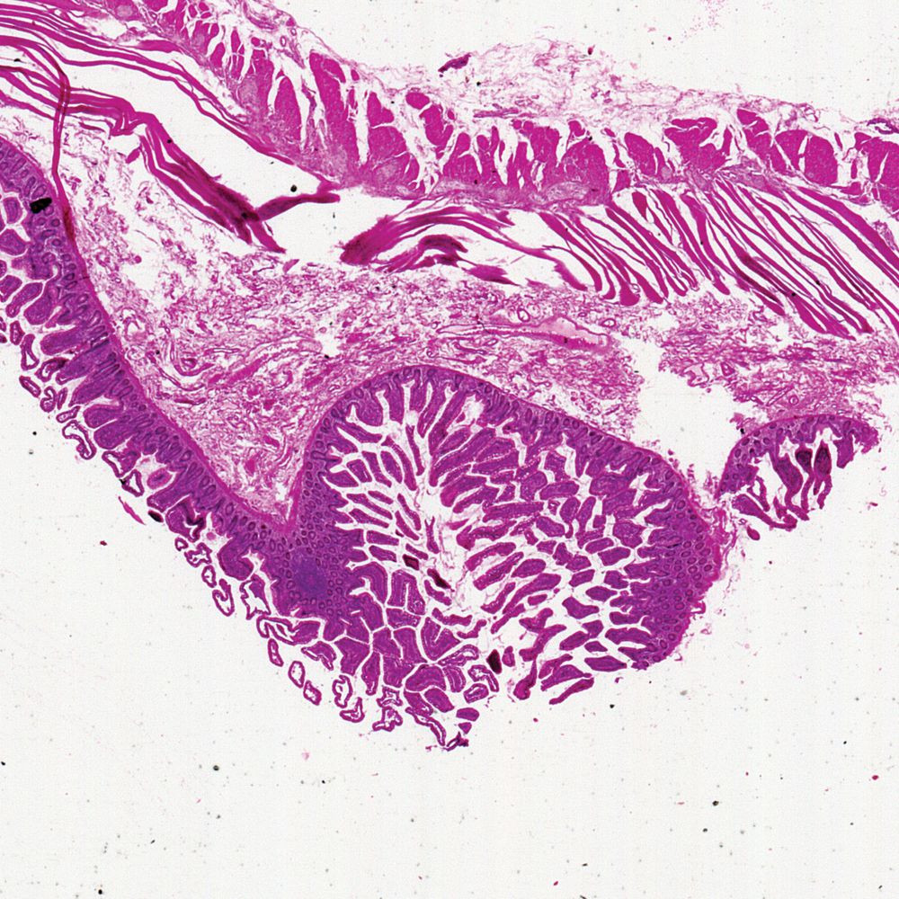 Human Jejunum, c.s. 7 µm H&E Microscope Slide - Southern Biological