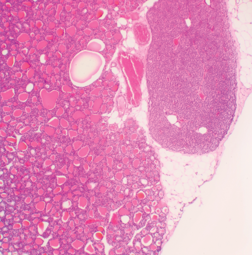 Mammal Thyroid Gland and Parathyroid Gland, sec. 7 µm H&E Microscope ...
