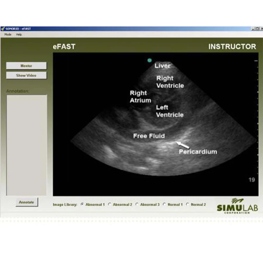 SonoMan Diagnostic Ultrasound Simulator