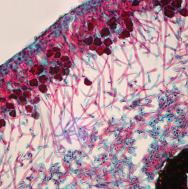 Common Microorganisms Microscope Slide Set