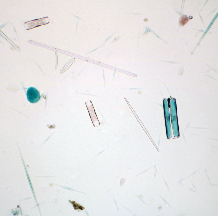 Beginner's Algae Microscope Slide Set