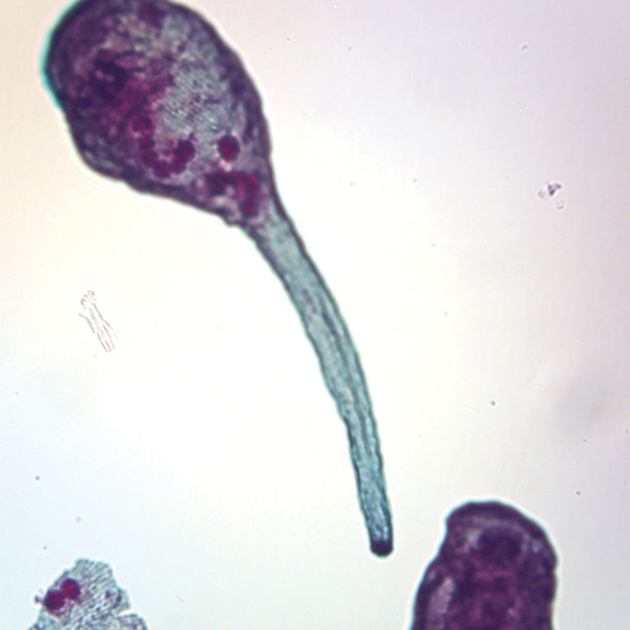 Beginner's Protozoan Microscope Slide Set